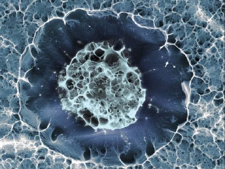 EU approves first allogenic therapy for Crohn’s disease Alofisel