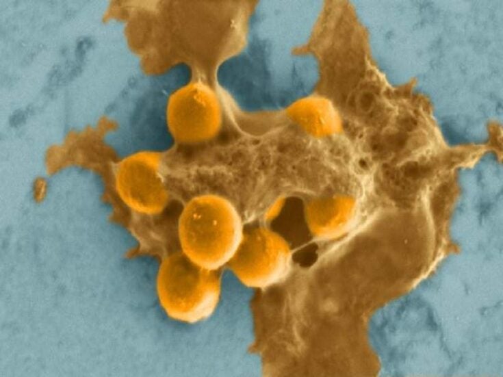 Researchers discover starving bacteria of iron may combat AMR