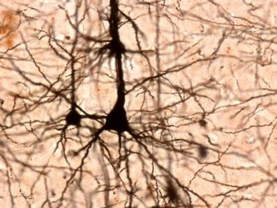 Blue Brain Project clarifies neurons' structure and role in disease ...