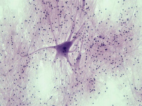 MSD and Crick Institute partner on motor neurone disease research