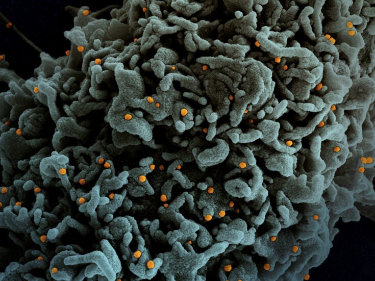 NIH begins trial of Moderna’s Covid-19 variant vaccine