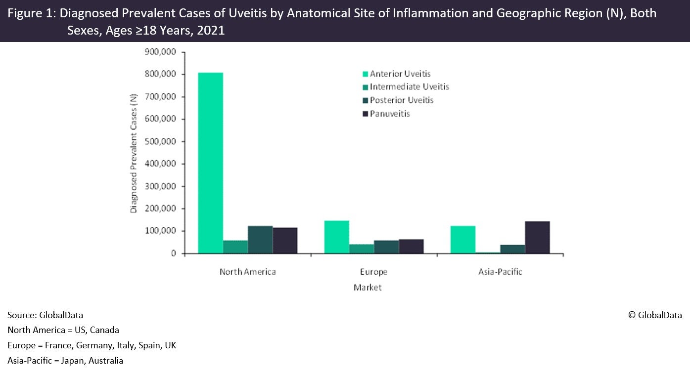 Uveitis' anatomical location in APAC differs from Europe and North America