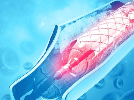 Stryker Archives - Pharmaceutical Technology