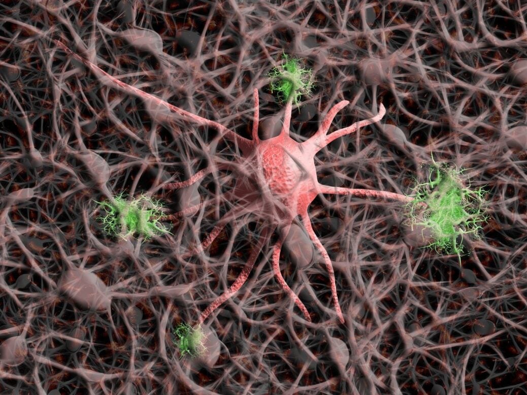 GSK and Alector to develop antibodies for neurodegenerative diseases