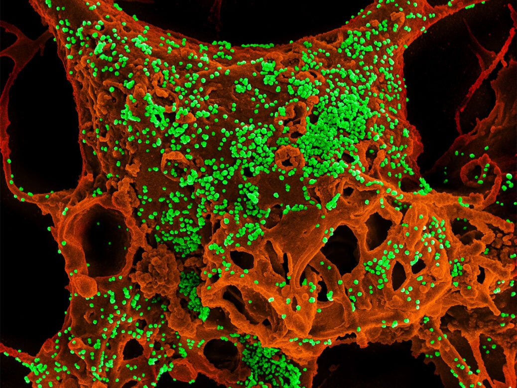 Adamis seeks FDA fast-track designation for Tempol against Covid-19