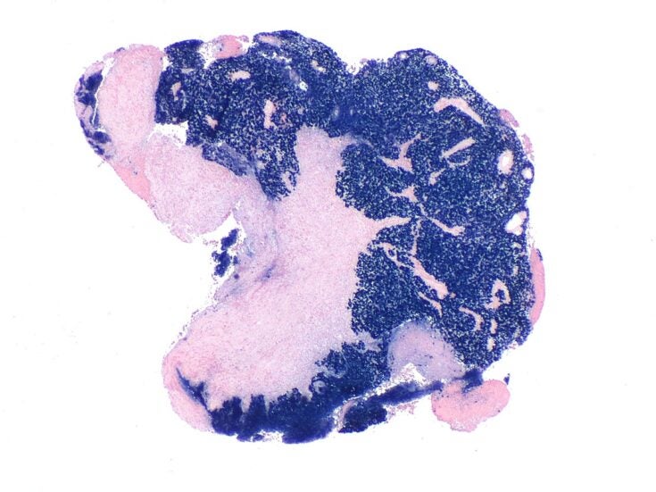 Amgen concludes acquisition of biotech company Teneobio for $2.5bn