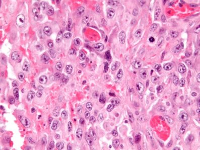 Thermo Fisher Scientific acquires Novasep’s Henogen for $874.5m