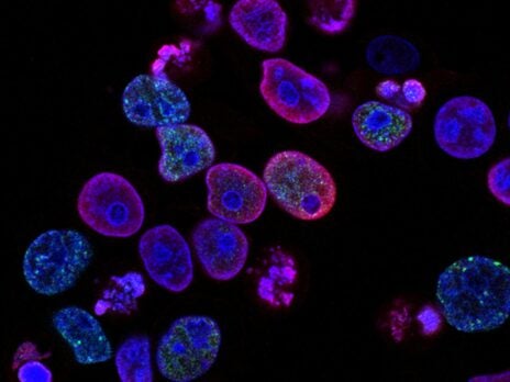 Thermo Fisher Scientific acquires Novasep’s Henogen for $874.5m