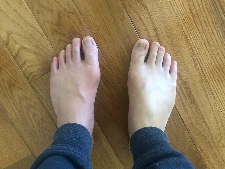 Verastem to divest Copiktra rights to Secura Bio for up to $381m ...