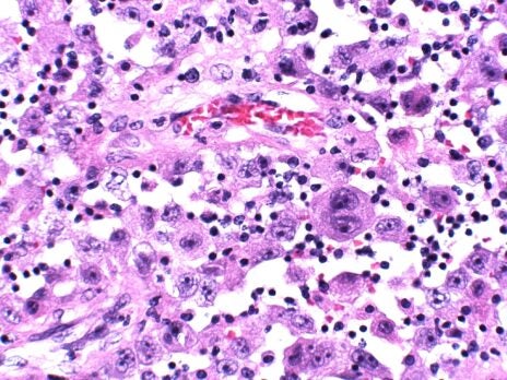 Pfizer concludes Arena Pharmaceuticals acquisition for $6.7bn