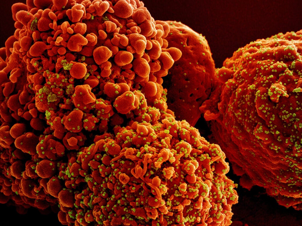 InflaRx seeks US FDA authorisation for Covid-19 treatment