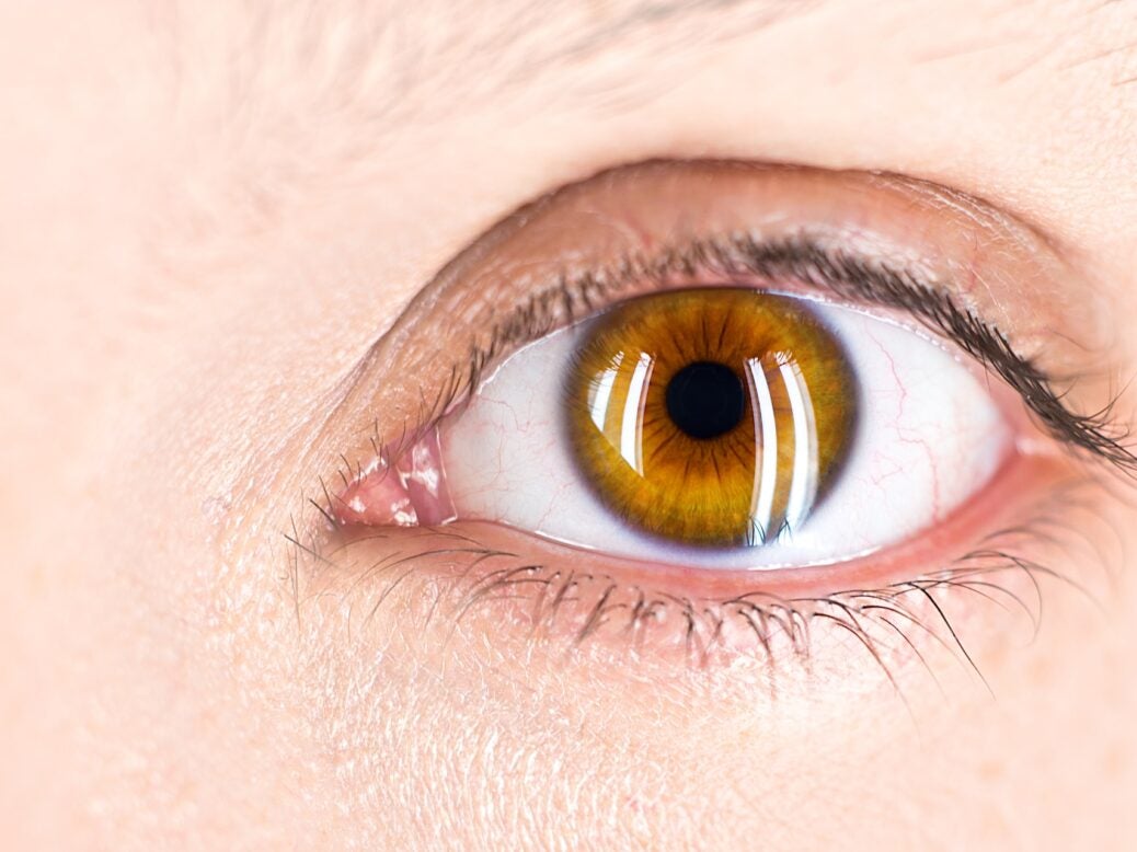 Surrozen and Boehringer partner to develop therapy for retinal diseases