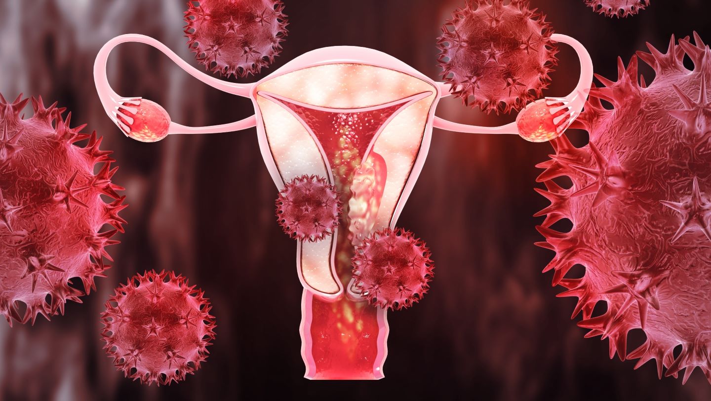UK NHS introduces new endometrial cancer immunotherapy
