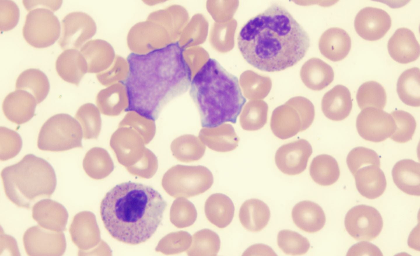 FDA approves Geron’s RYTELO for MDS associated anaemia