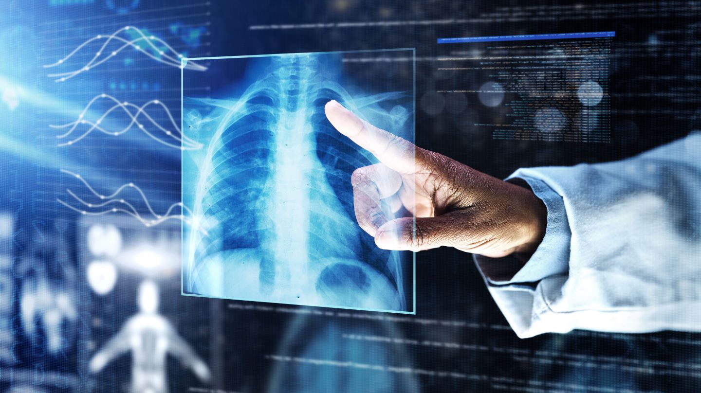 Roche’s Alecensa obtains EC approval for ALK-positive NSCLC