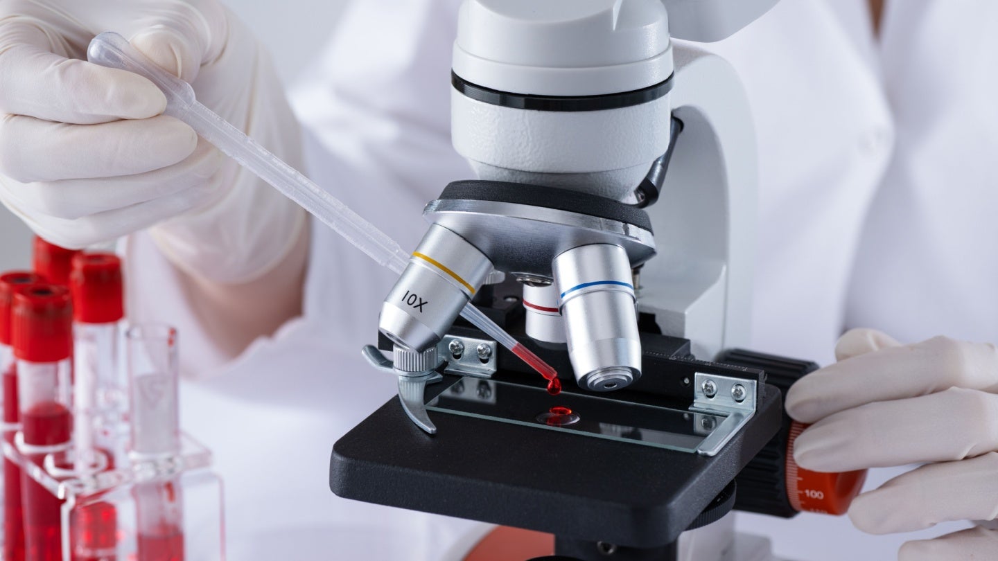 Modella AI and AstraZeneca link for cancer clinical development