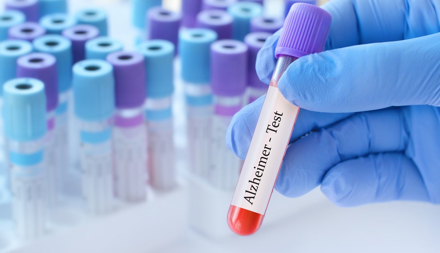 FDA to review Eisai’s Leqembi Iqlik sBLA for Alzheimer’s